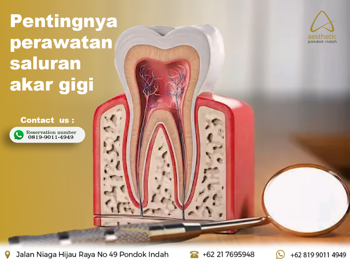 Root Canal Treatment - Klinik Gigi Jakarta - Dokter Gigi Jakarta Selatan | Aesthetic Pondok ...